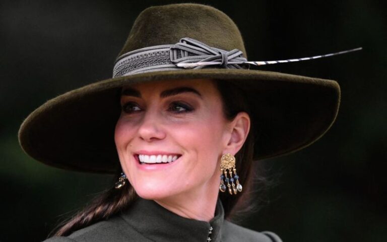 Kate Middleton’s face before and after getting botox injections to look ...