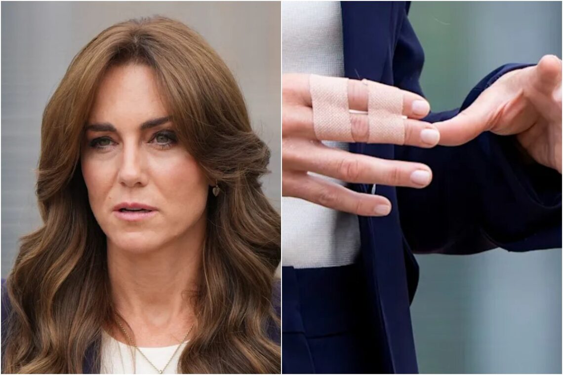 Kate Middleton visited men's prison, but all eyes were on the injury on ...