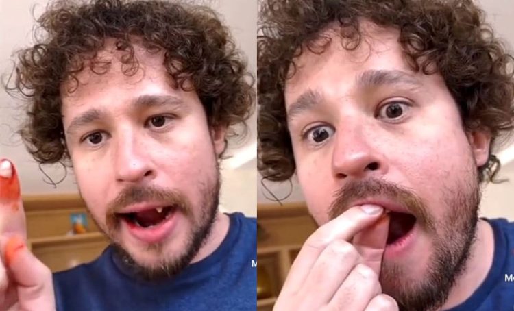 El turbio vídeo de Luisito Comunica arrancándose un diente en pleno live de Instagram
