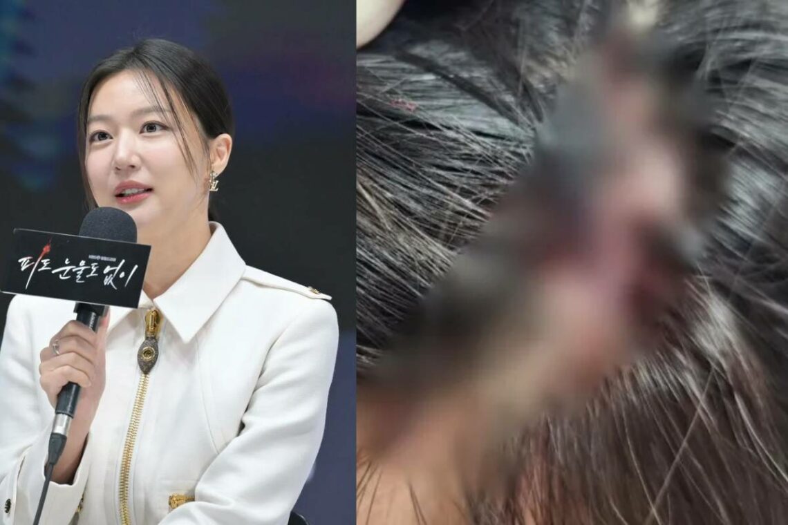Ha Yeon Ju, actriz de K-Dramas, sufre fuerte golpe en su cabeza durante ...